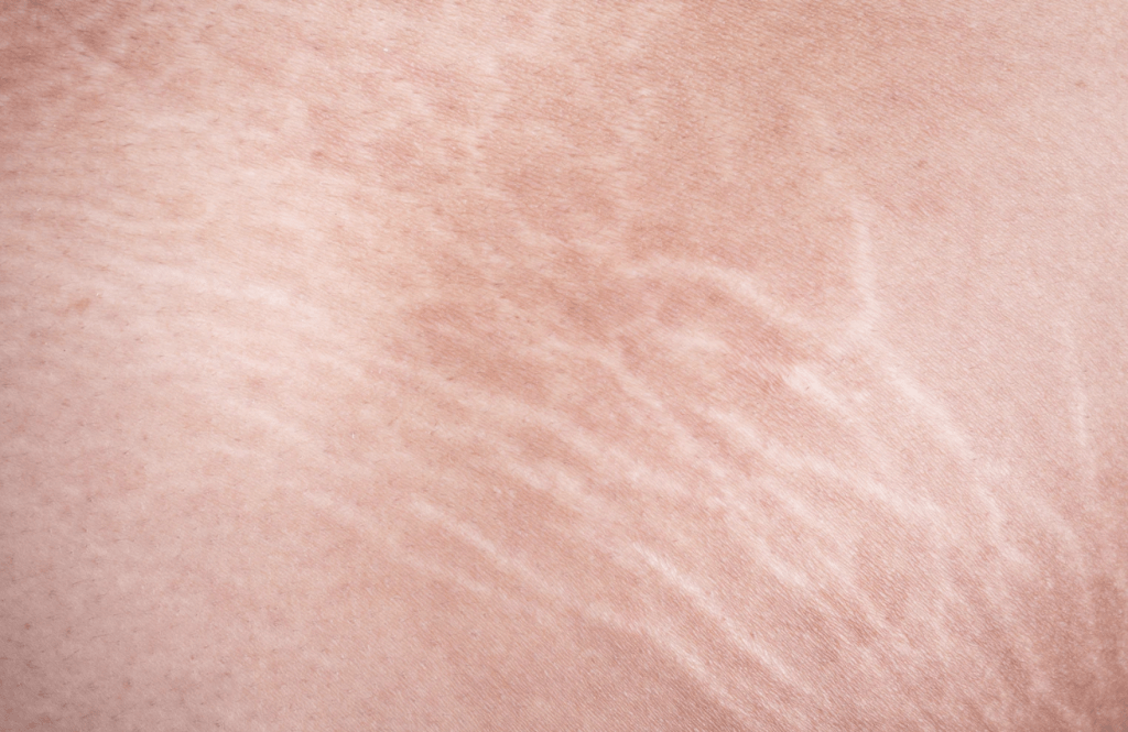 What Causes Skin Marks and Discoloration? - Scoop Empire